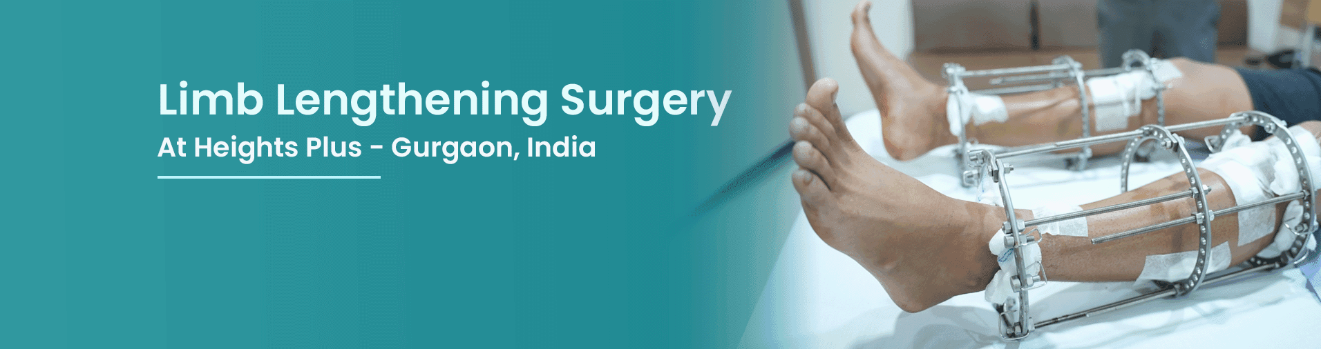 Limb lengthening Surgery Treatment - Heights Plus