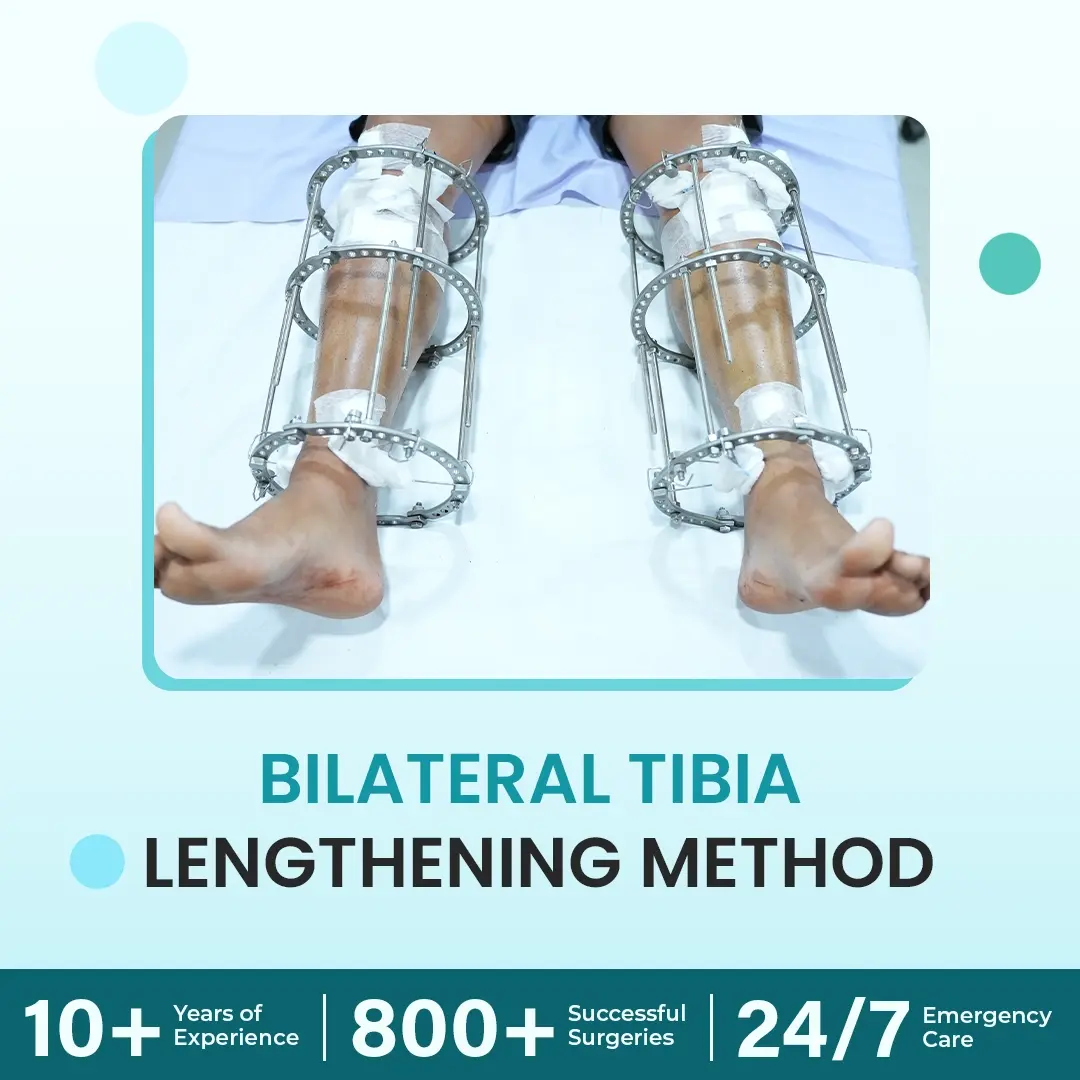 Bilateral Femoral Lengthening Surgery - Heights Plus
