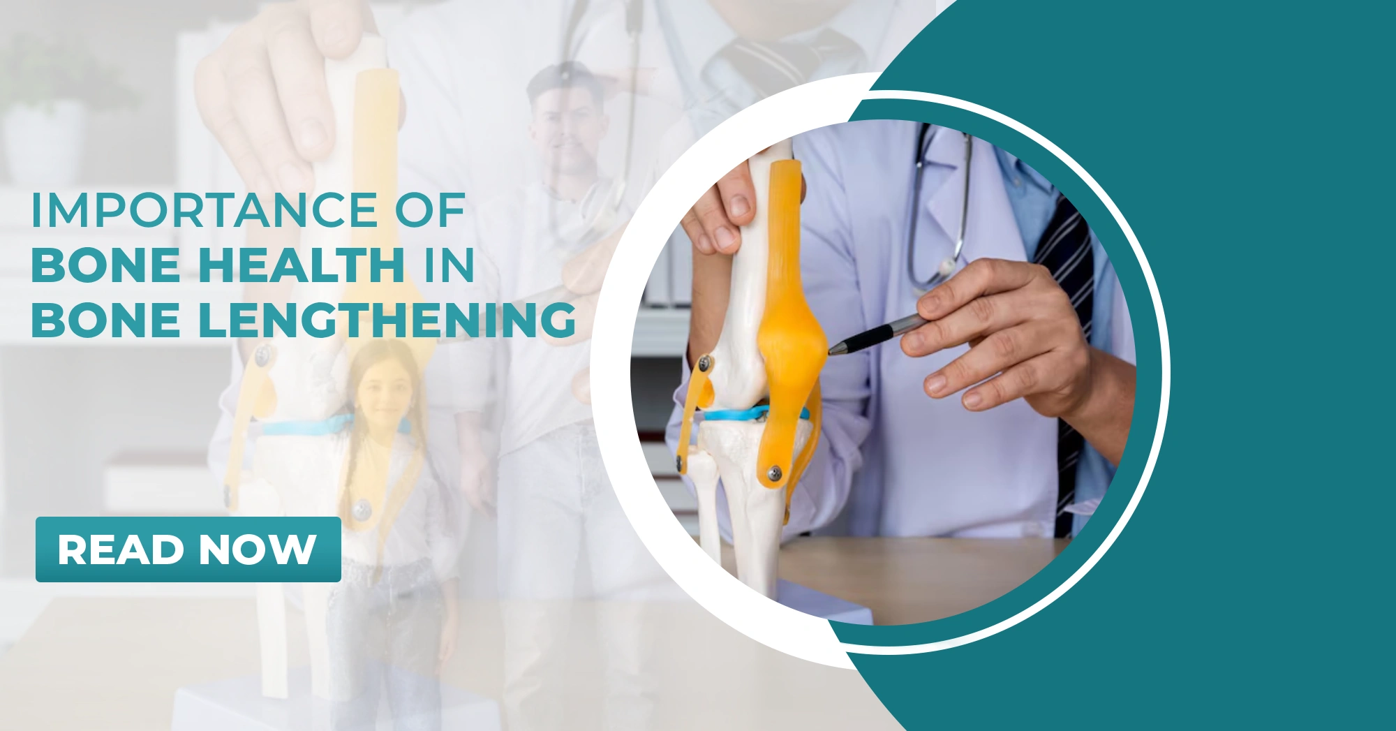 Importance Of Bone Health In Bone Lengthening